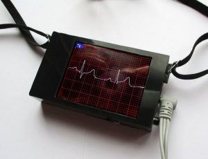 Arduino ECG Display: Building a Visual Interface for Heart Health